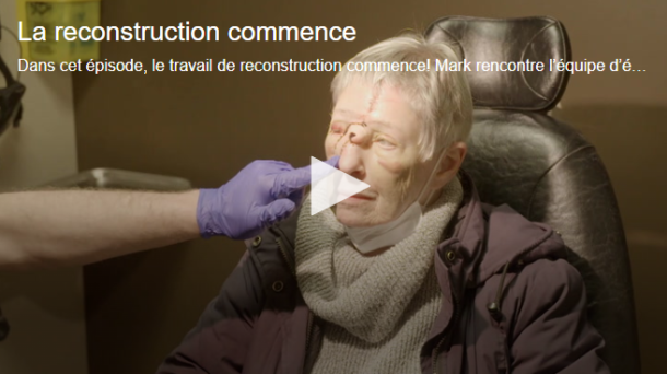 Émission "Reconstruire le corps" - Département d'ophtalmologie ...